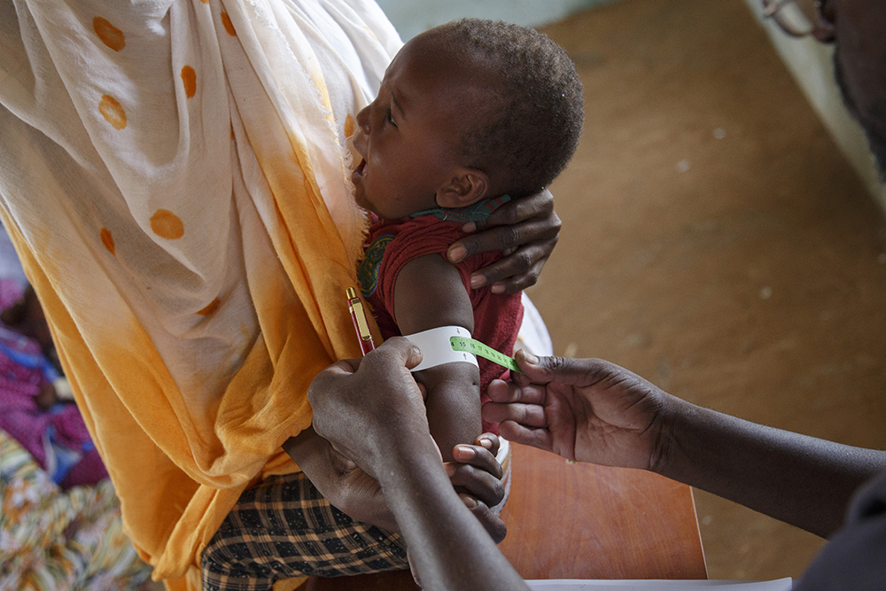 Detectando la desnutrición a tiempo | Save the Children